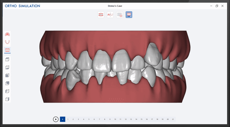 Ortho Simulation